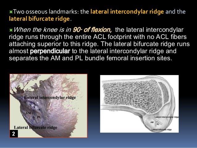 Evolution of tunnel placement in ACL reconstruction