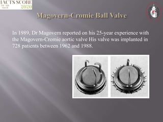 Evolution of valves, Identification & Key Features | IACTS SCORE 2020 ...