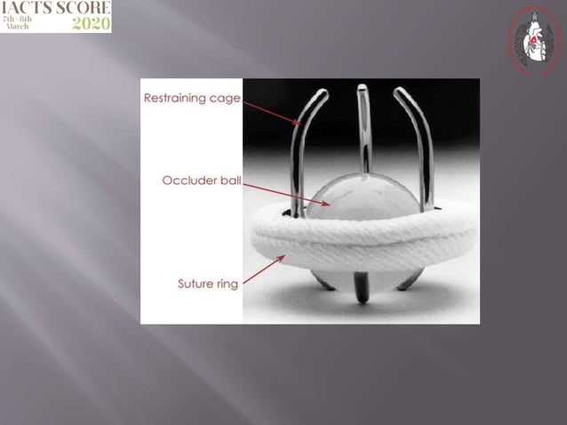 Evolution of valves, Identification & Key Features | IACTS SCORE 2020 | PPT