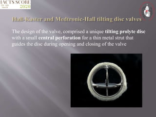 Evolution of valves, Identification & Key Features | IACTS SCORE 2020 ...