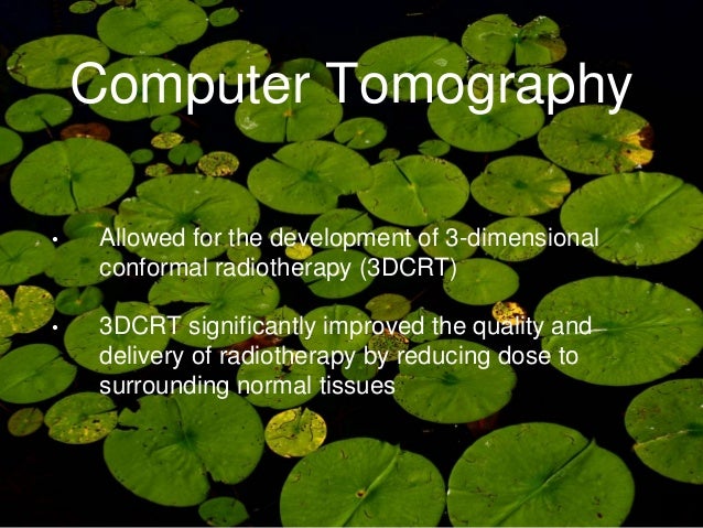 The Evolution Of Radiation Therapy