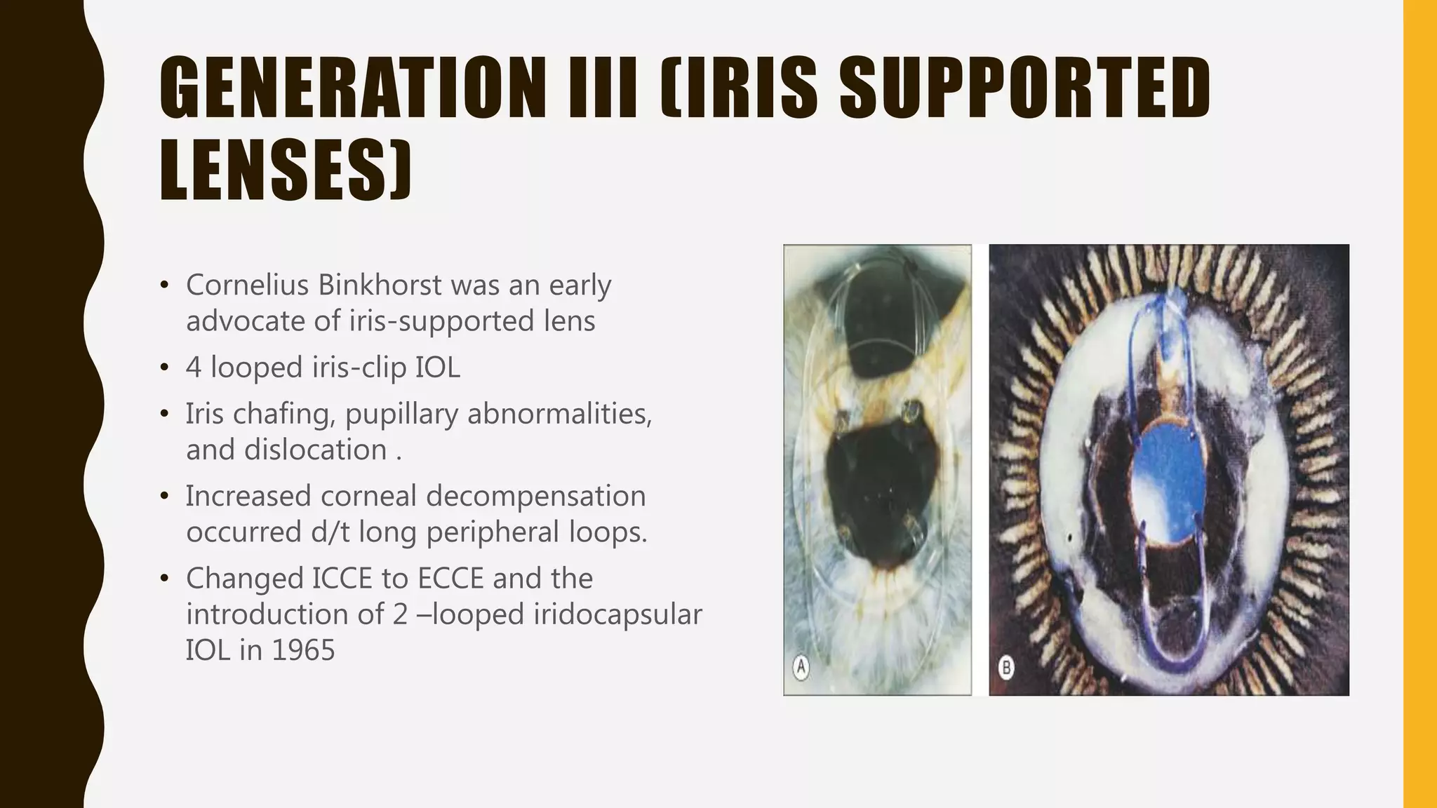 Evolution, types, materials of iol | PPTX