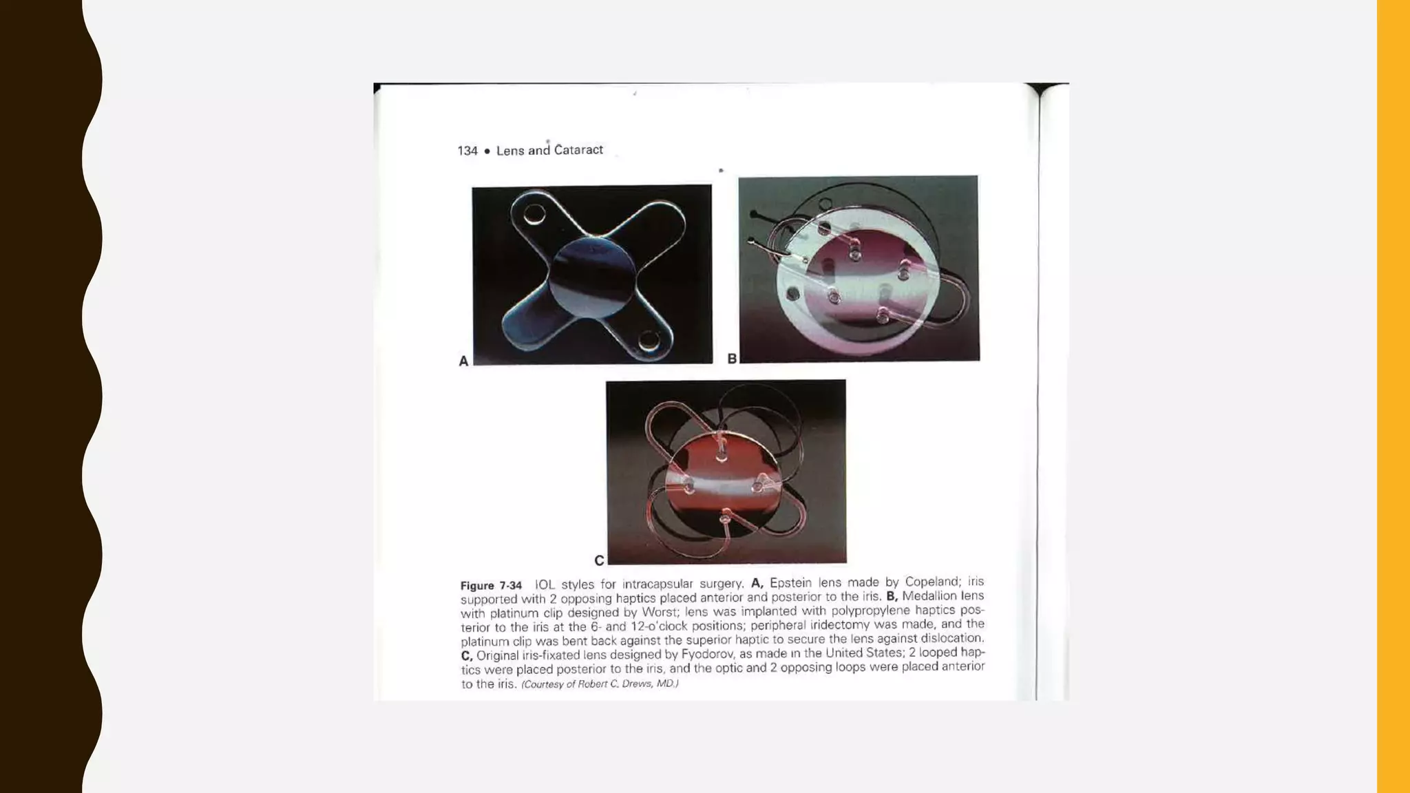 Evolution, types, materials of iol | PPTX
