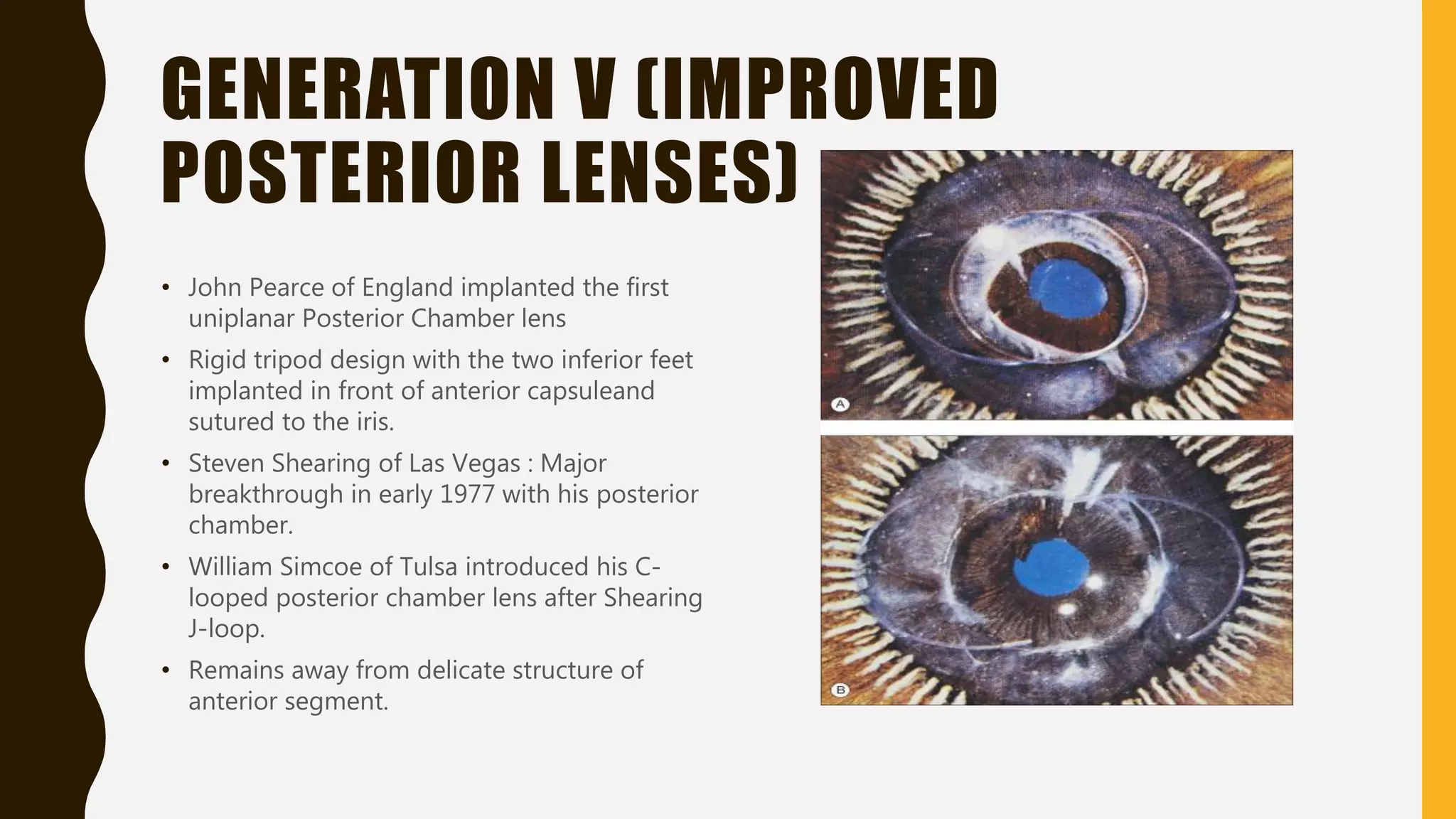 Evolution, types, materials of iol | PPTX