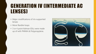 Evolution, types, materials of iol | PPTX