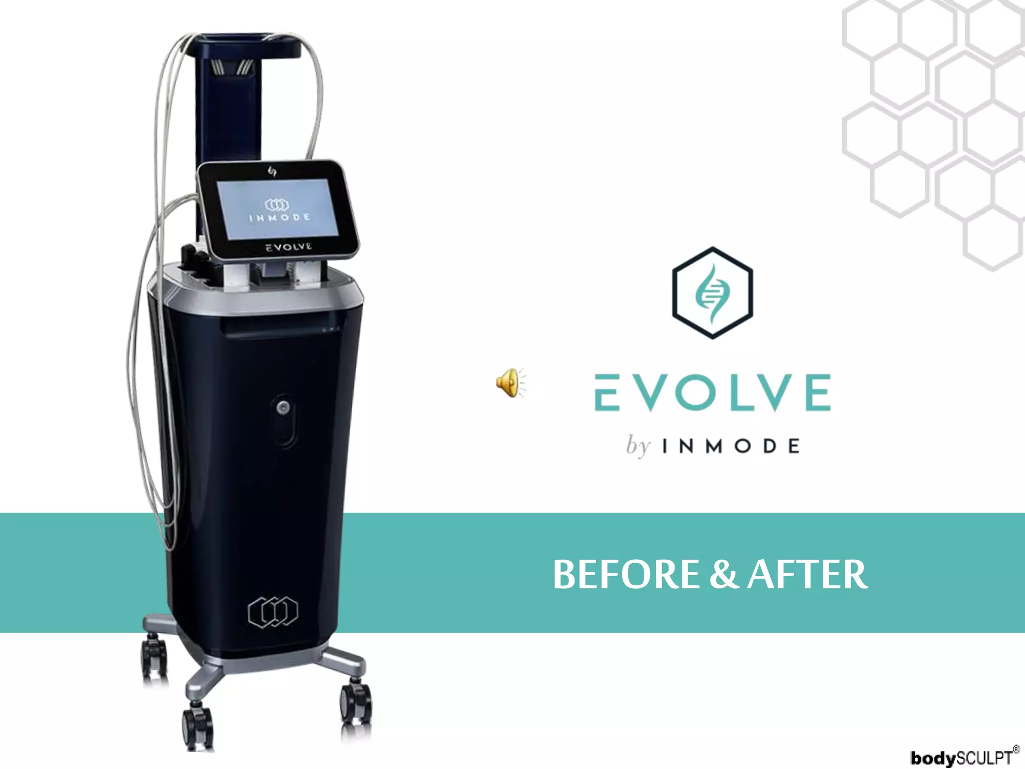 EVOLVE by InMode – Before & After | PPSX