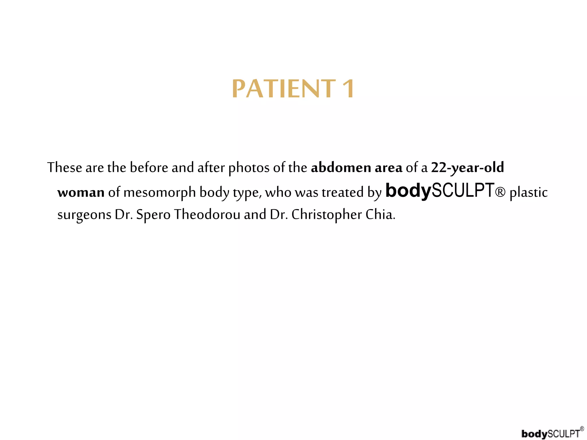 EVOLVE by InMode – Before & After | PPSX