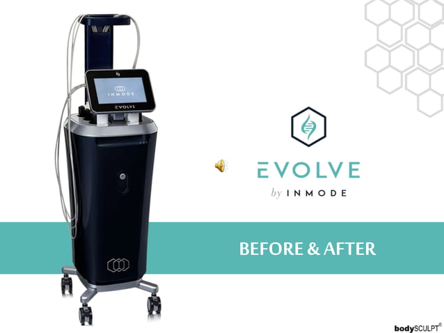 EVOLVE by InMode – Before & After | PPT