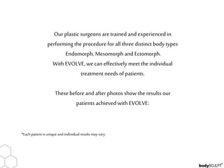 EVOLVE by InMode – Before & After | PPT