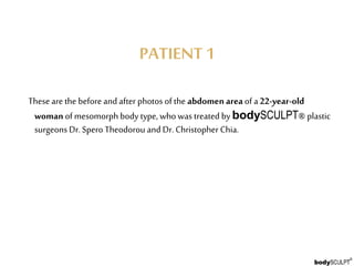 EVOLVE by InMode – Before & After | PPT