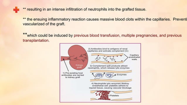 Transplantationandrejection Classification Of Graft Rejection