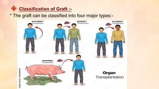 transplantation_and_rejection , classification of graft , rejection ...