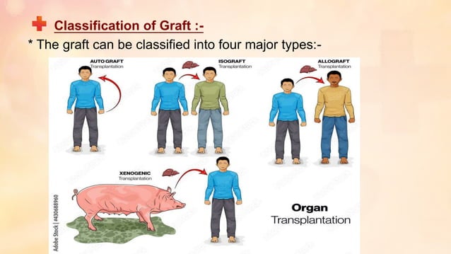 Transplantationandrejection Classification Of Graft Rejection