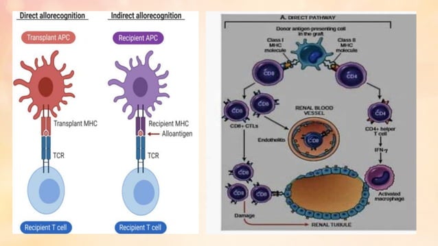 transplantation_and_rejection , classification of graft , rejection ...
