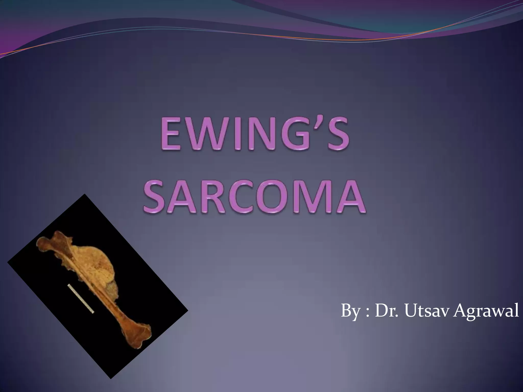 Ewings sarcoma_UTSAV | PPTX