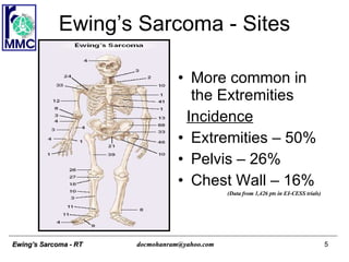 Ewings Sarcoma | PPT