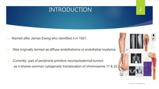 Ewing’s sarcoma | PPTX