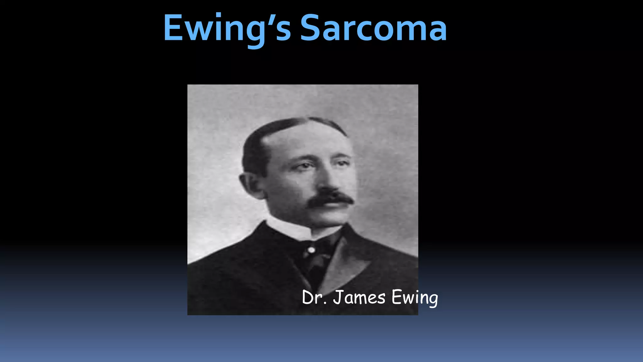 Ewing’s sarcoma | PPTX