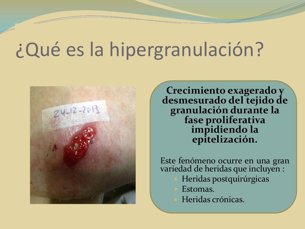 EWMA 2014 - EP396 HYPERGRANULATION APPROACH