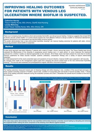 EWMA 2014 - EP398 IMPROVING HEALING OUTCOMES FOR PATIENTS WITH VENOUS ...