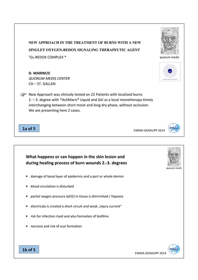 EWMA 2014 - EP431 NEW APPROACH IN THE TREATMENT OF BURNS WITH A NEW ...