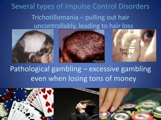 Impulse Control Disorder | PPTX