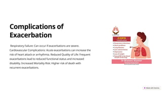 Exacerbation-of-Chronic-Obstructive-Pulmonary-Disease-COPD.pptx