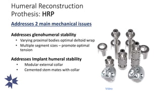 Exactech Humeral Reconstruction Prosthesis Overview | PPT