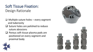 Exactech Humeral Reconstruction Prosthesis Overview | PPT