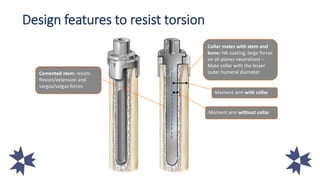 Exactech Humeral Reconstruction Prosthesis Overview | PPT