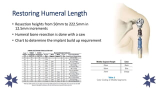 Exactech Humeral Reconstruction Prosthesis Overview | PPT