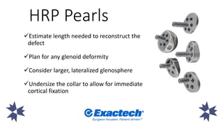 Exactech Humeral Reconstruction Prosthesis Overview | PPT