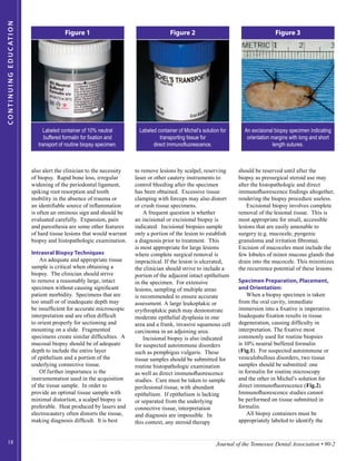 Exam 19 the oral biopsy - indications, techniques and special ...