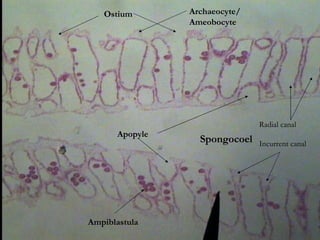 Grantia Longitudinal Section Labeled