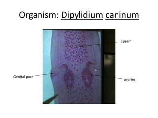 Dipylidium Slide Labeled