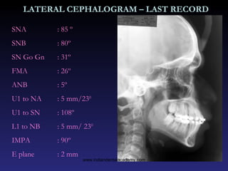 Exam case report | PPT