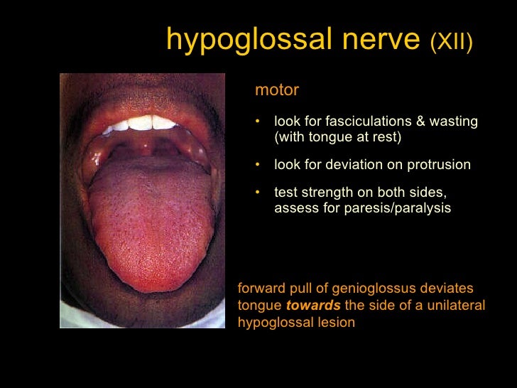 Tongue Deviation