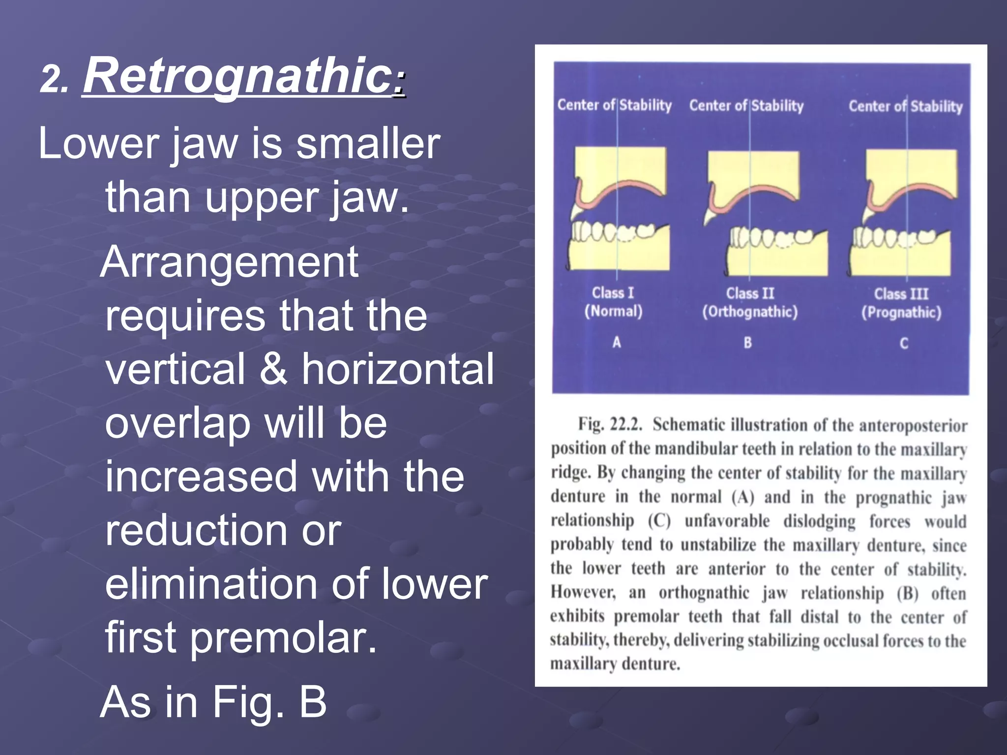Examination, Diagnosis, Treatment Planing I | PPT