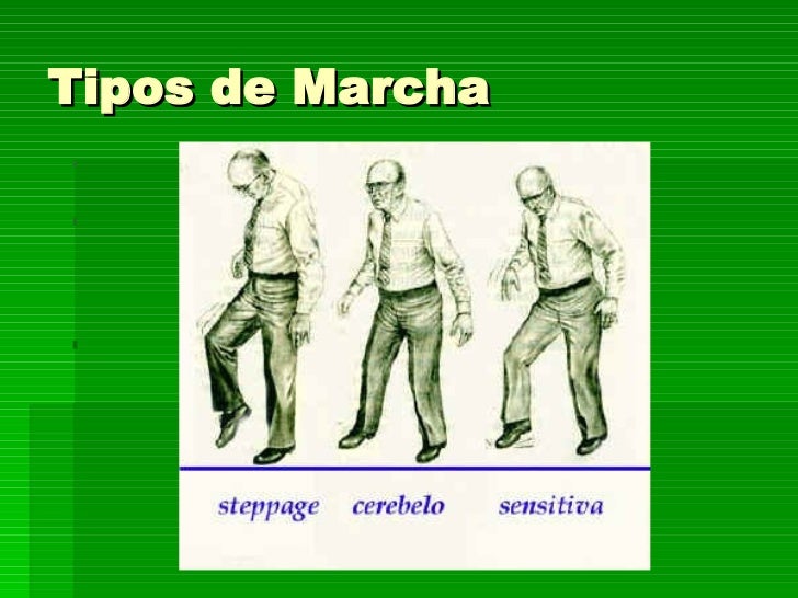 Exame Neurologico Marcha