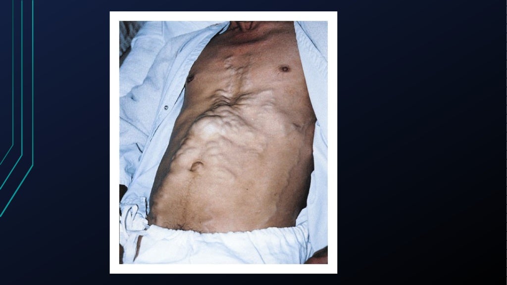 Exame físico abdome i