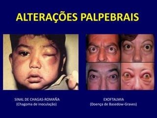 Exame fisico cabeça e pescoço | PPTX