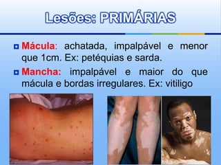 Exame físico Pele e Fâneros.pdf