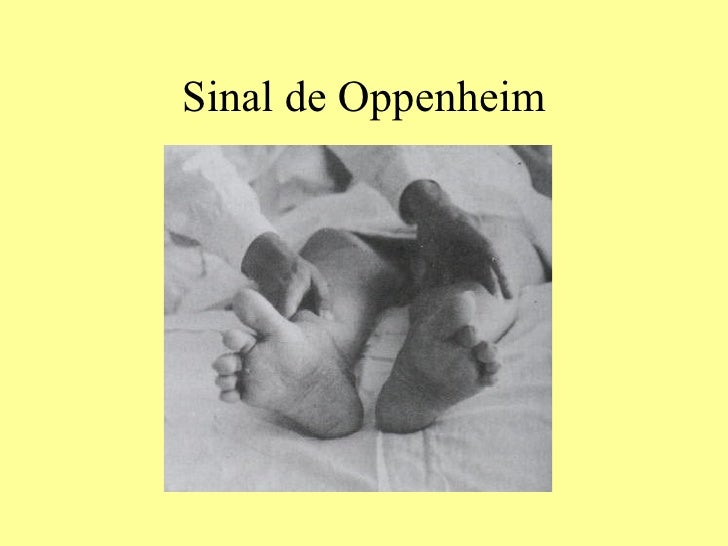 Semiologia Básica: Exame Físico Neurológico