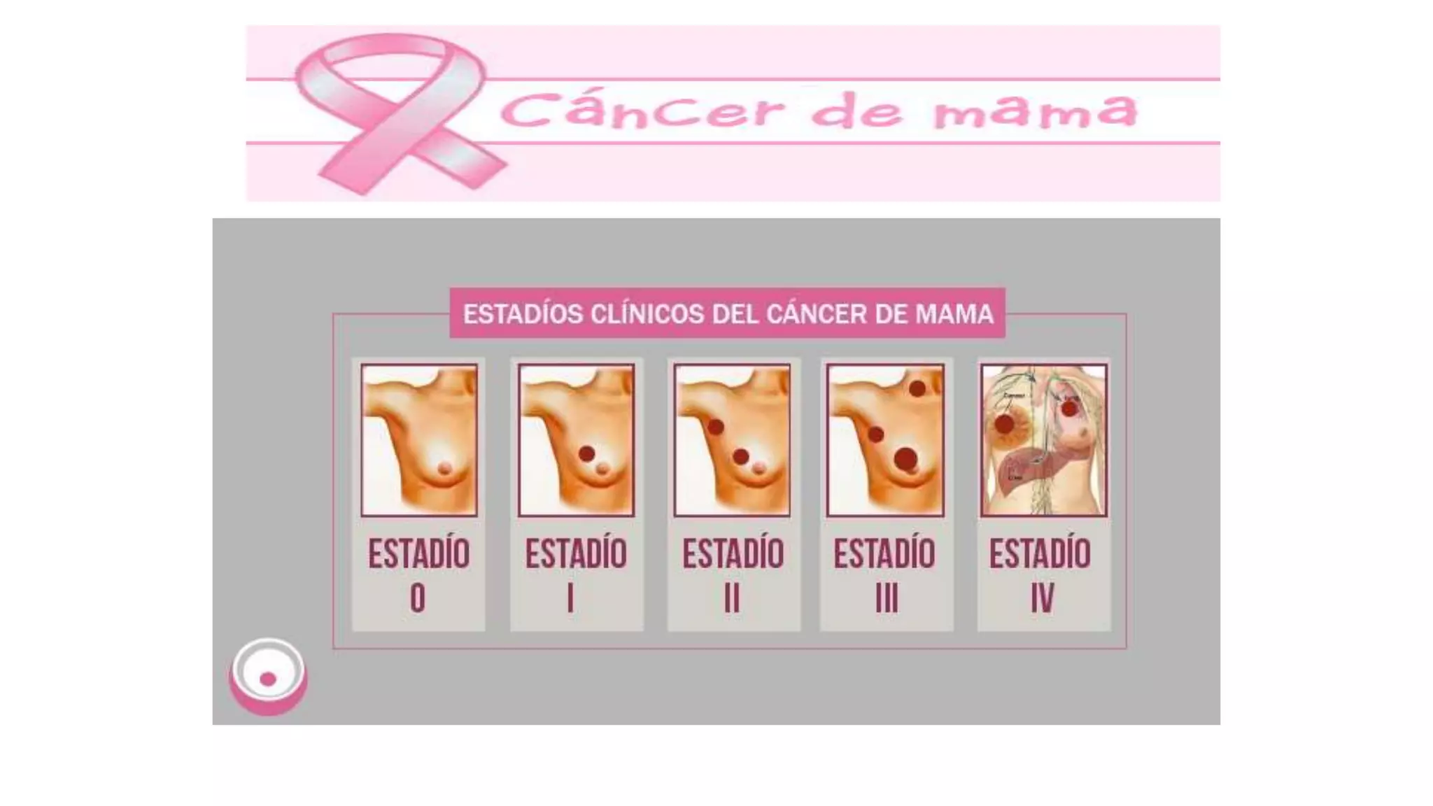 Examen de-mamas | PPTX