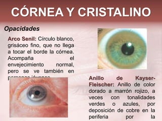 Examen de Ojo | PPTX