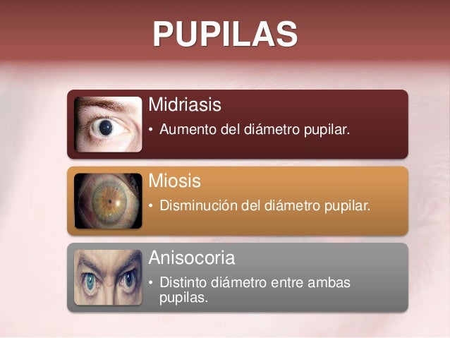 Miosis Y Midriasis