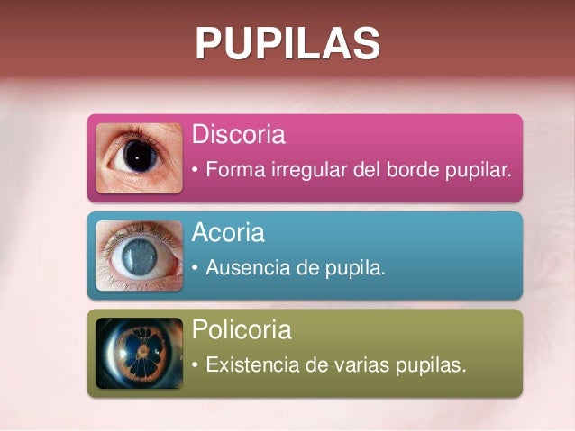 Examen de Ojo