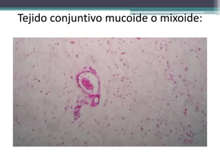Repaso examen de laminillas de tejido epitelial y tejido conjuntivo | PPTX