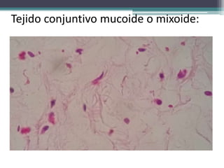 Repaso examen de laminillas de tejido epitelial y tejido conjuntivo | PPTX