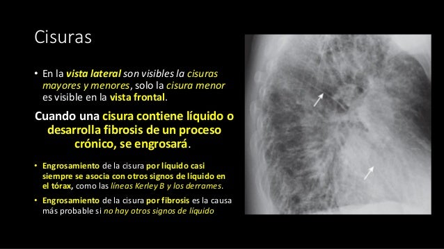 Examen 1 learning radiology